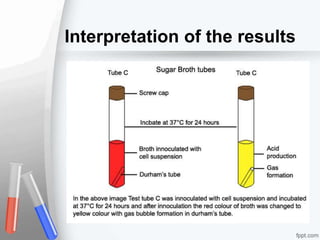 Sugar fermentation tests, Cetrimide agar medium, Hugh Leifson medium | PPTX