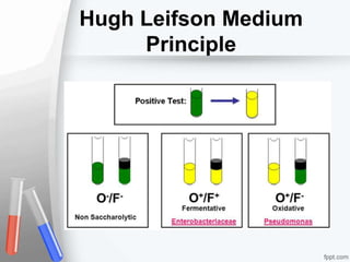 Sugar fermentation tests, Cetrimide agar medium, Hugh Leifson medium | PPTX