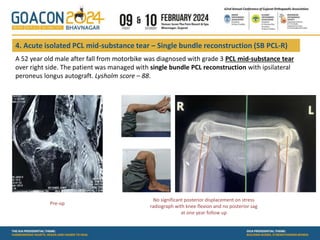 Shivam Sharma PPT GxtbbcfgbbcvOACON.pptx