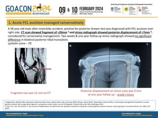 Shivam Sharma PPT GxtbbcfgbbcvOACON.pptx