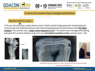 Shivam Sharma PPT GxtbbcfgbbcvOACON.pptx