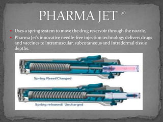 Needle Less Injection Technology by S Shivani Shastrulagari. | PPTX ...