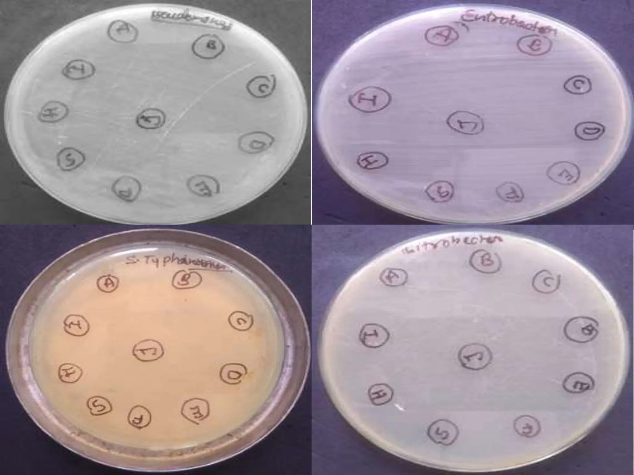 Isolation And Characterization Of Bacteriophages Against Staphylococcus
