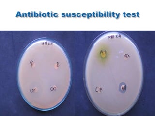 Isolation and characterization of Bacteriophages against Staphylococcus aureus | PPT