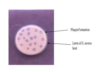 Isolation and characterization of Bacteriophages against Staphylococcus aureus | PPT