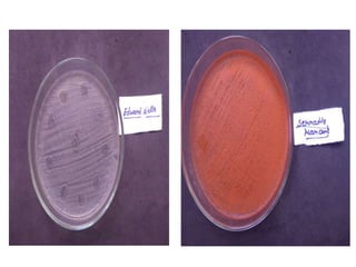 Isolation and characterization of Bacteriophages against Staphylococcus aureus | PPT