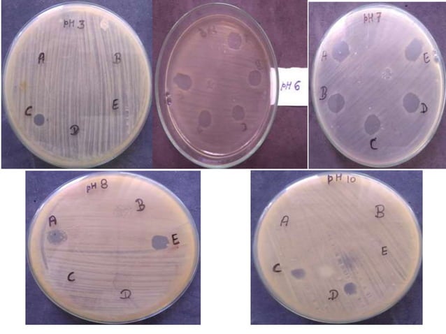 Isolation And Characterization Of Bacteriophages Against Staphylococcus