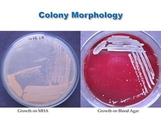 Isolation and characterization of Bacteriophages against Staphylococcus aureus | PPT