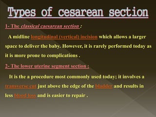 Cesarian section and physical therapy role | PDF | Pregnancy ...