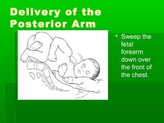 Shldr dystocia acog | PPT