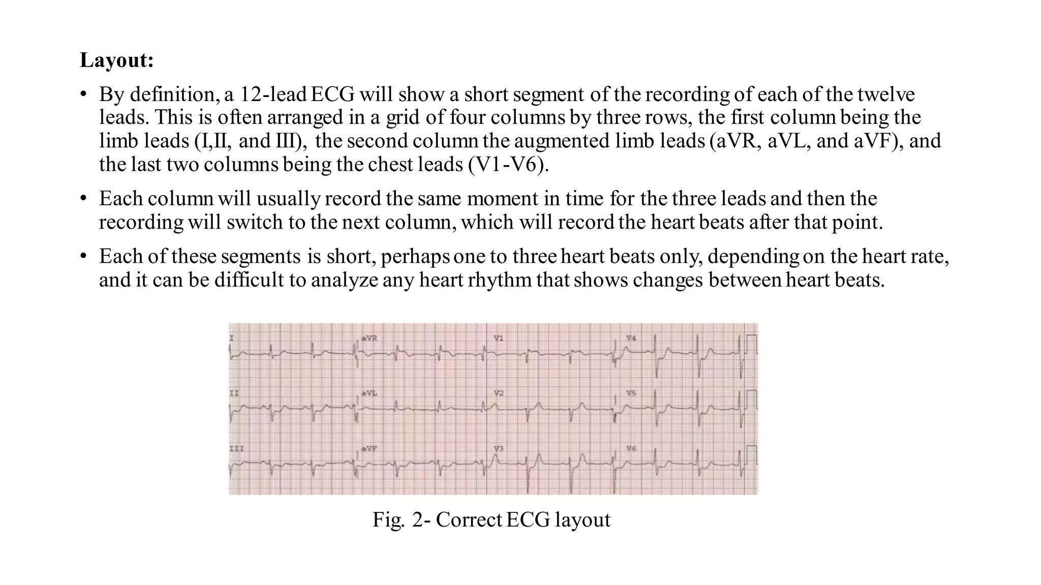 basics of ecg | PPT