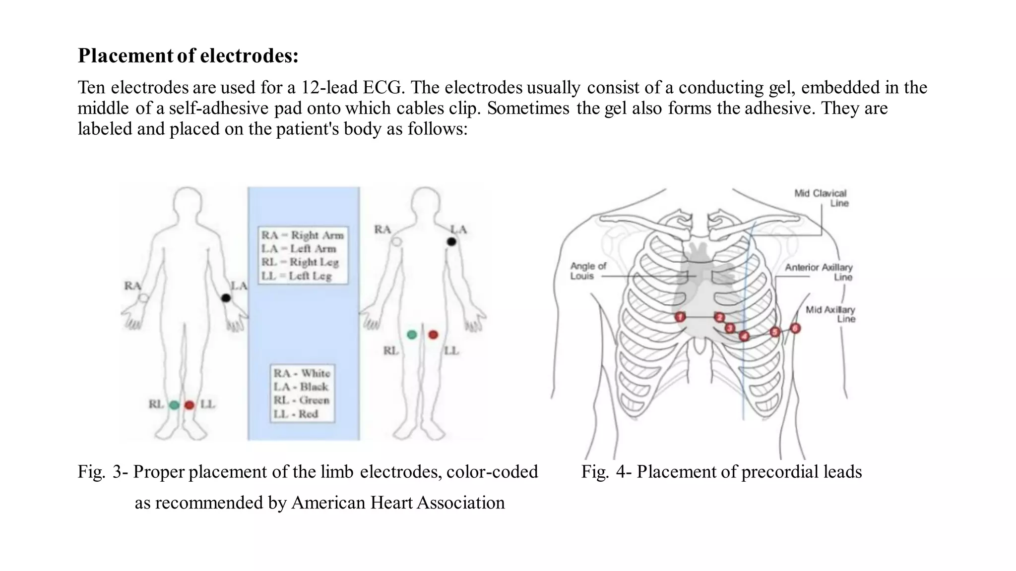 basics of ecg | PPT