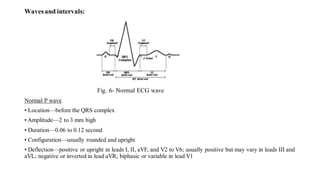 basics of ecg | PPT