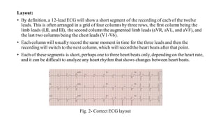 basics of ecg | PPT