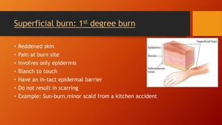 SHOBANA(BURNS).pptx