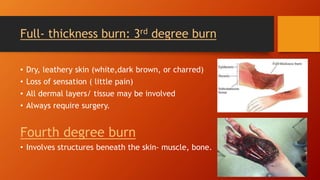 SHOBANA(BURNS).pptx