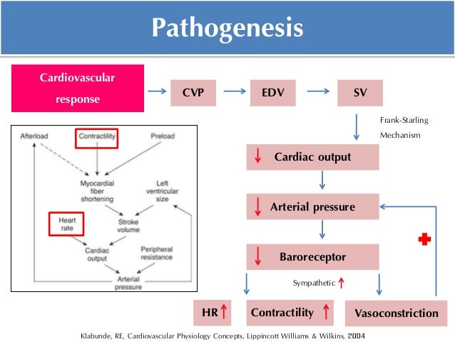 Hemorrhagic Shock