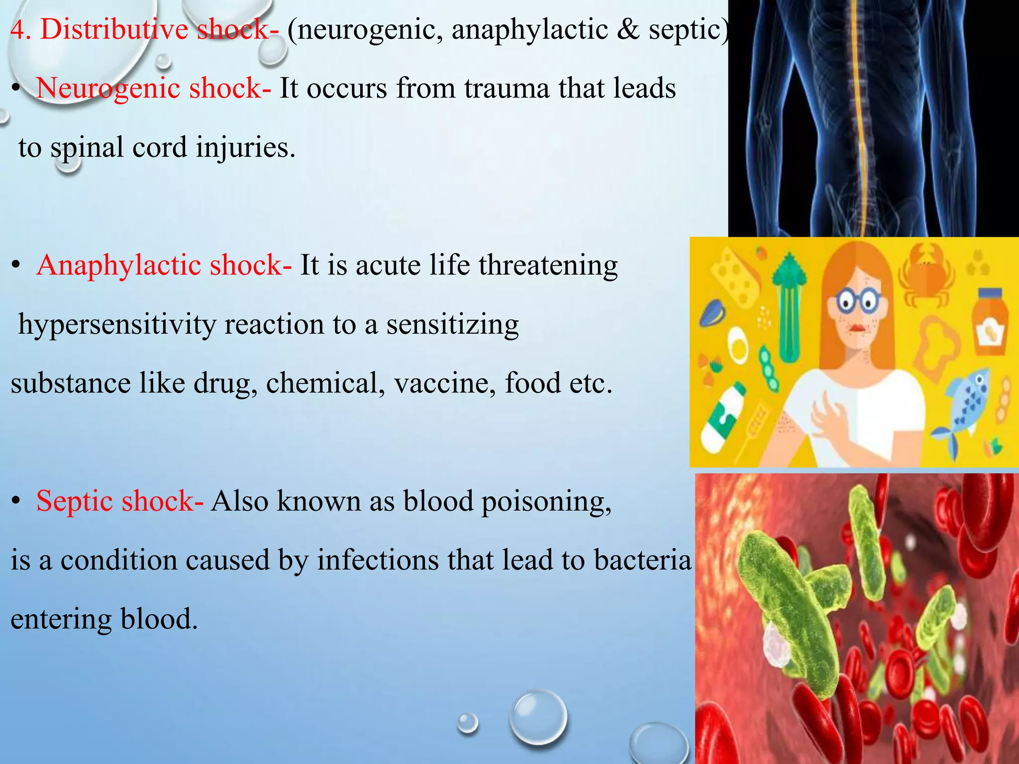 Shock | PPTX