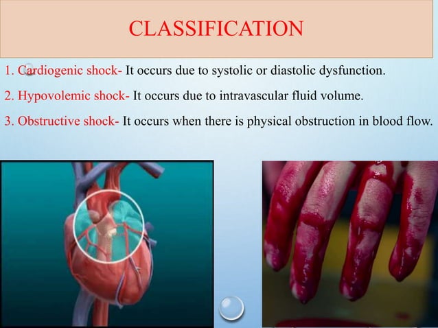 Shock | PPTX | Heart and Cardiovascular Diseases | Diseases and Conditions