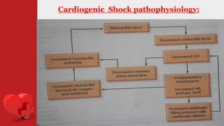 Shock | PPT