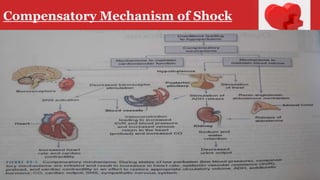 Shock | PPT