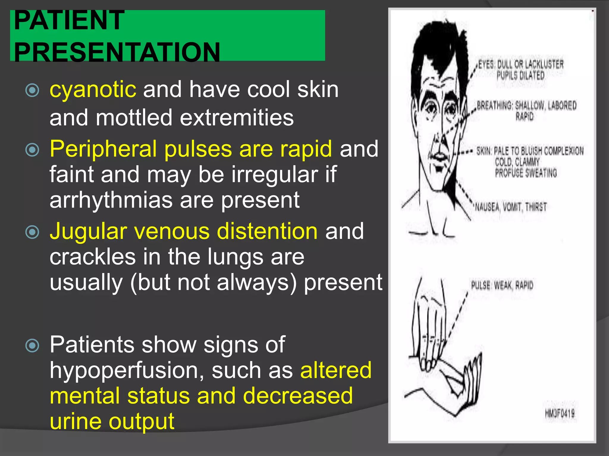CARDIOGENIC SHOCK | PPTX
