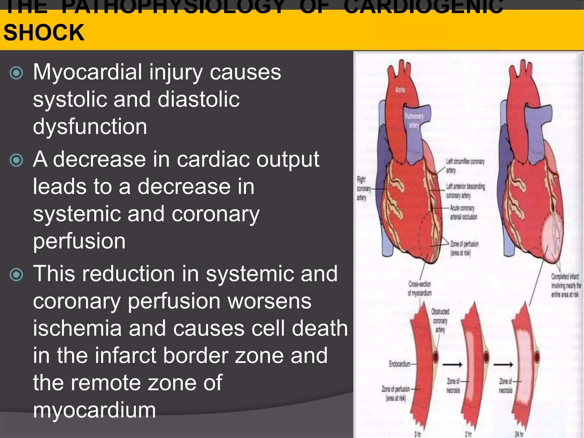 CARDIOGENIC SHOCK | PPTX