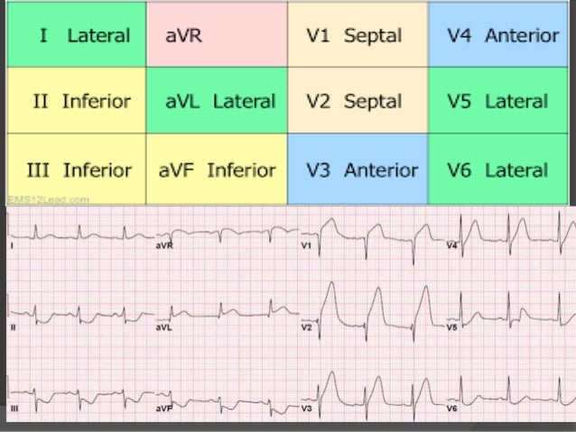 CARDIOGENIC SHOCK