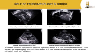 management of shock in neonates | PPTX