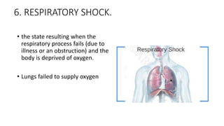 Shock | PPT