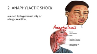Shock | PPT
