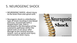Shock | PPT