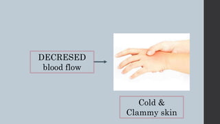 Classification of haemostatic disorders and shock | PPTX
