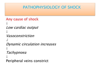 Shock | PPT