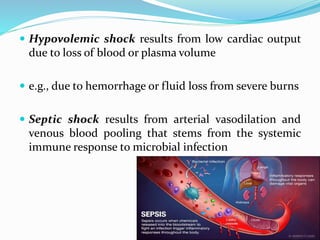 Shock | PPT