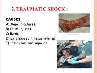 Shock and types of shock | PPTX