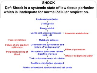 Shock | PPTX