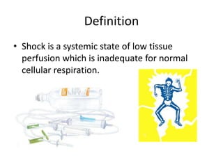 Shock | PPTX