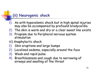 Shock.ppt