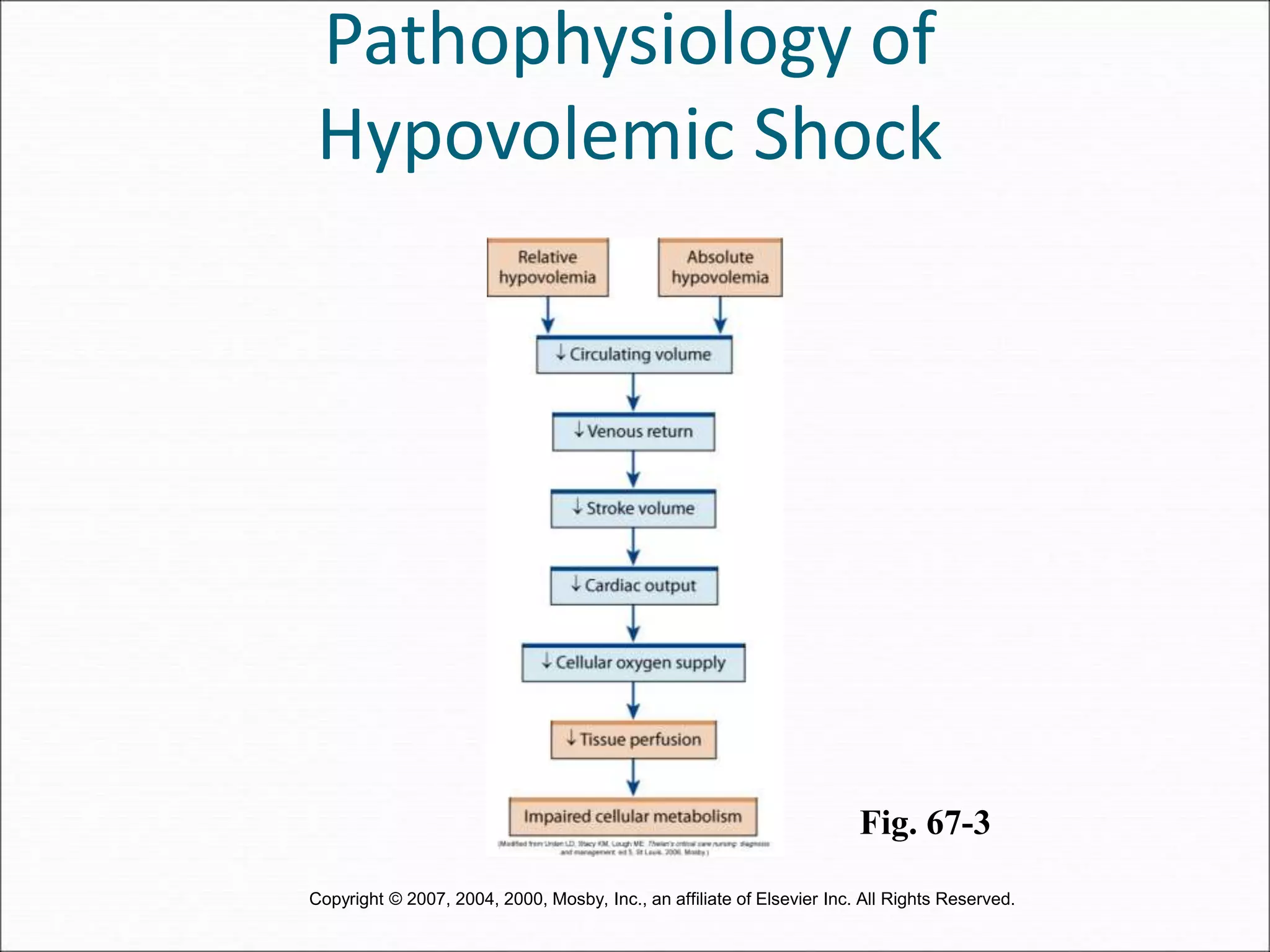 Shock.ppt