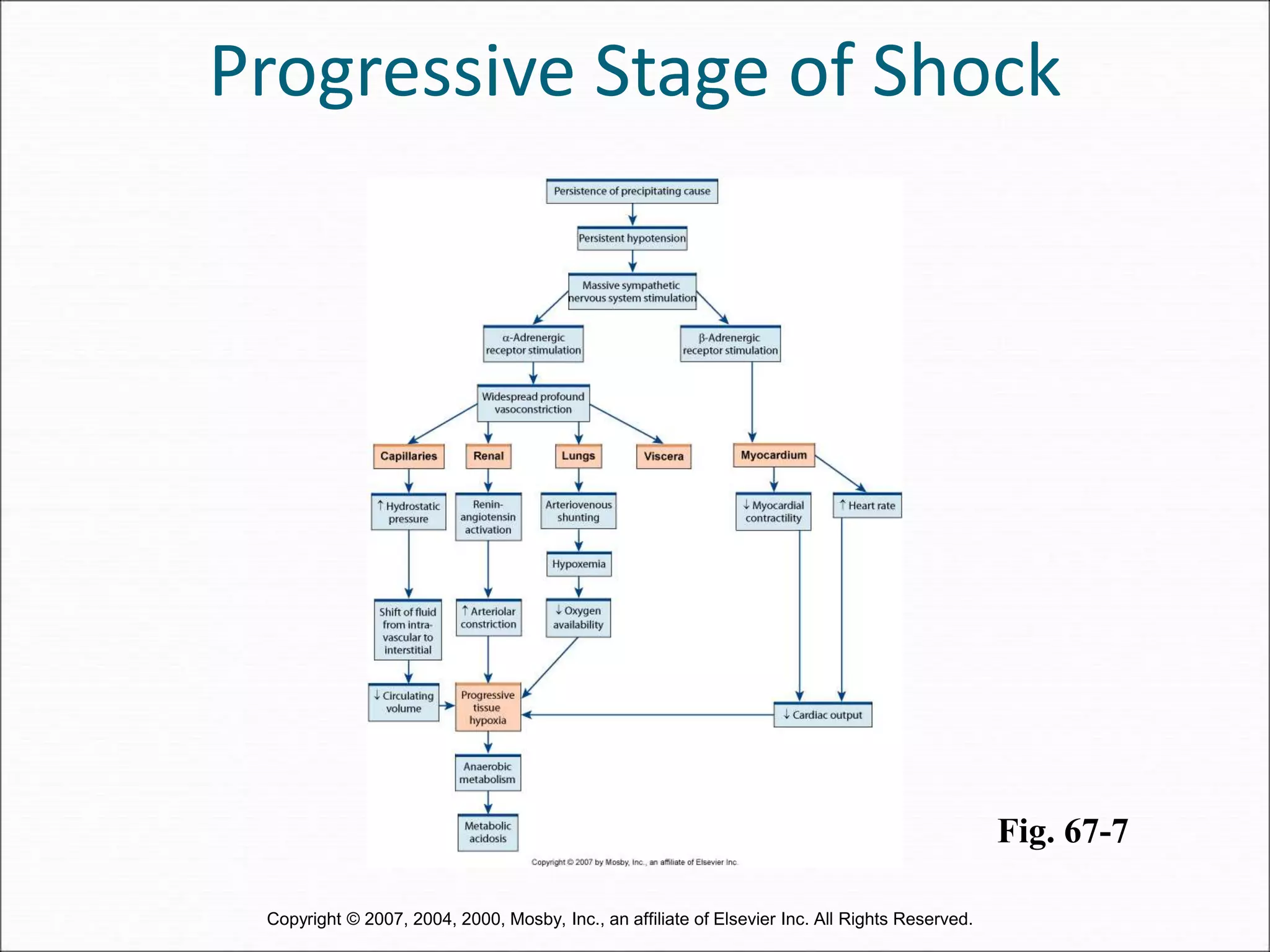 Shock.ppt