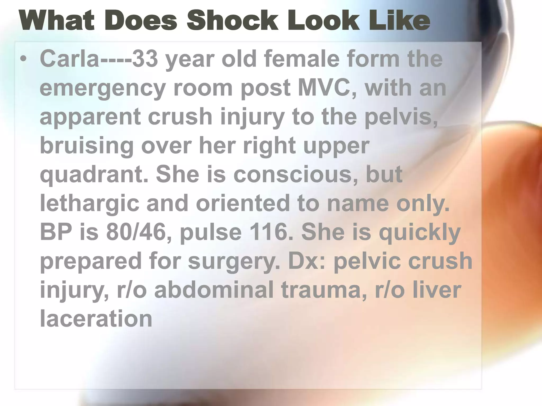 SHOCK.ppt