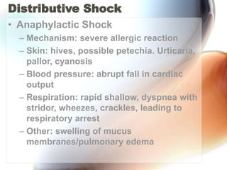 SHOCK.ppt