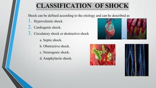 SHOCK | PDF