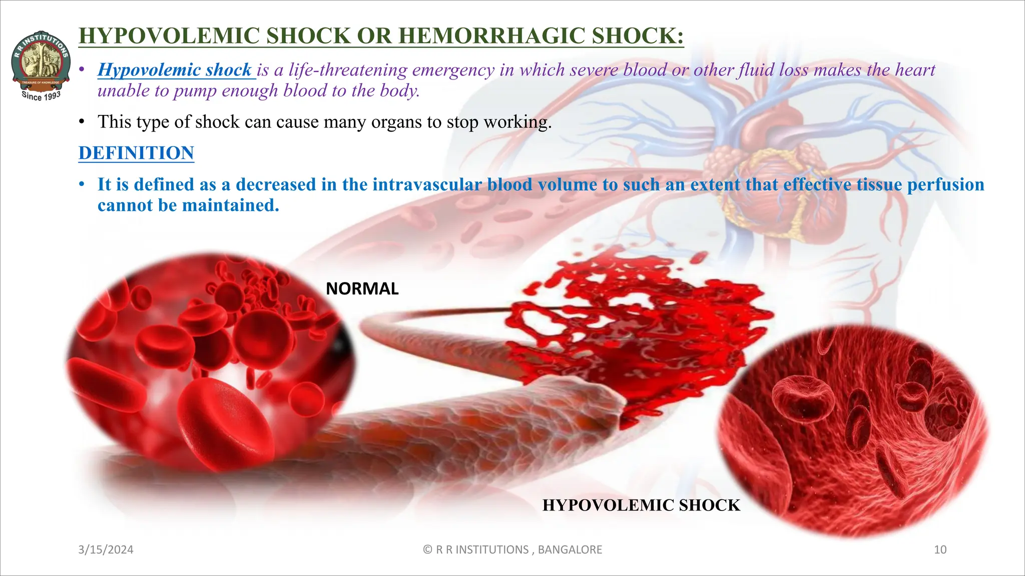 SHOCK/TYPES OF SHOCK AND ITS MANAGEMENT.pdf
