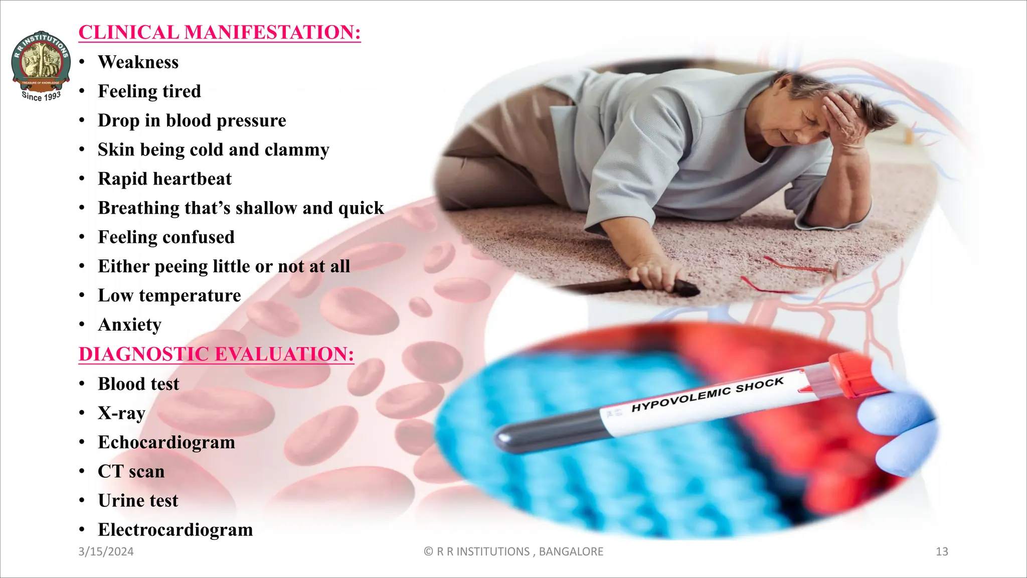 SHOCK/TYPES OF SHOCK AND ITS MANAGEMENT.pdf