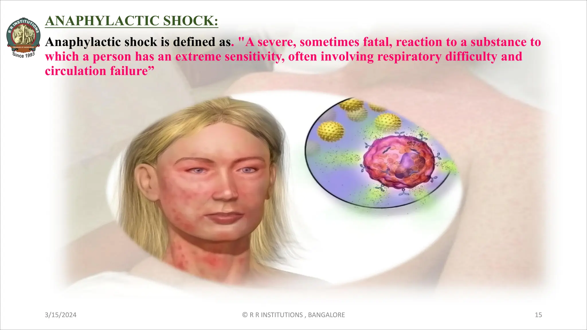 SHOCK/TYPES OF SHOCK AND ITS MANAGEMENT.pdf