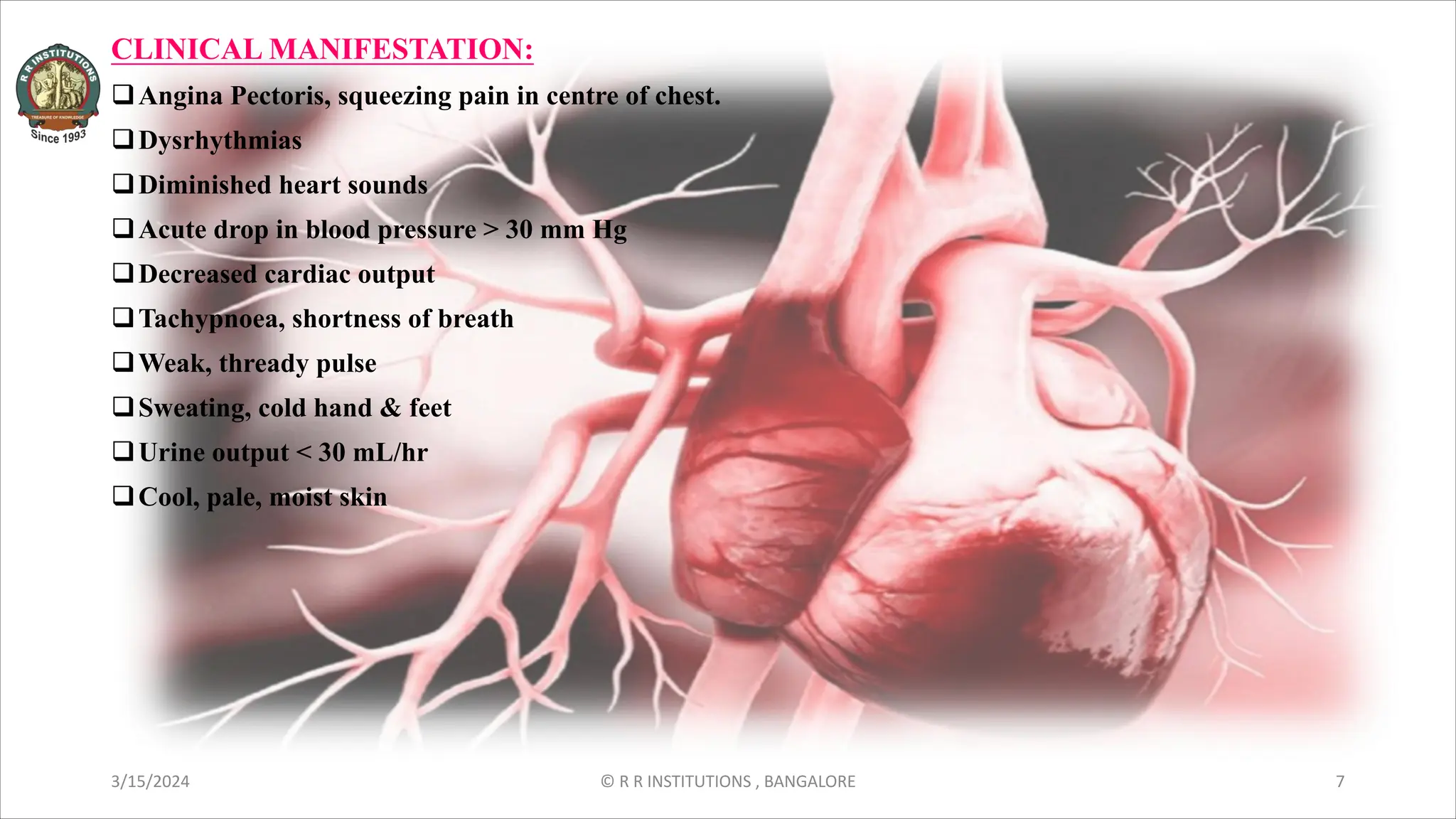SHOCK/TYPES OF SHOCK AND ITS MANAGEMENT.pdf