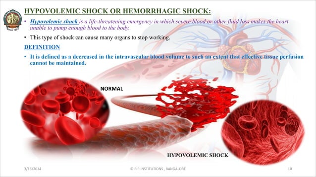 SHOCK/TYPES OF SHOCK AND ITS MANAGEMENT.pdf | Heart and Cardiovascular ...
