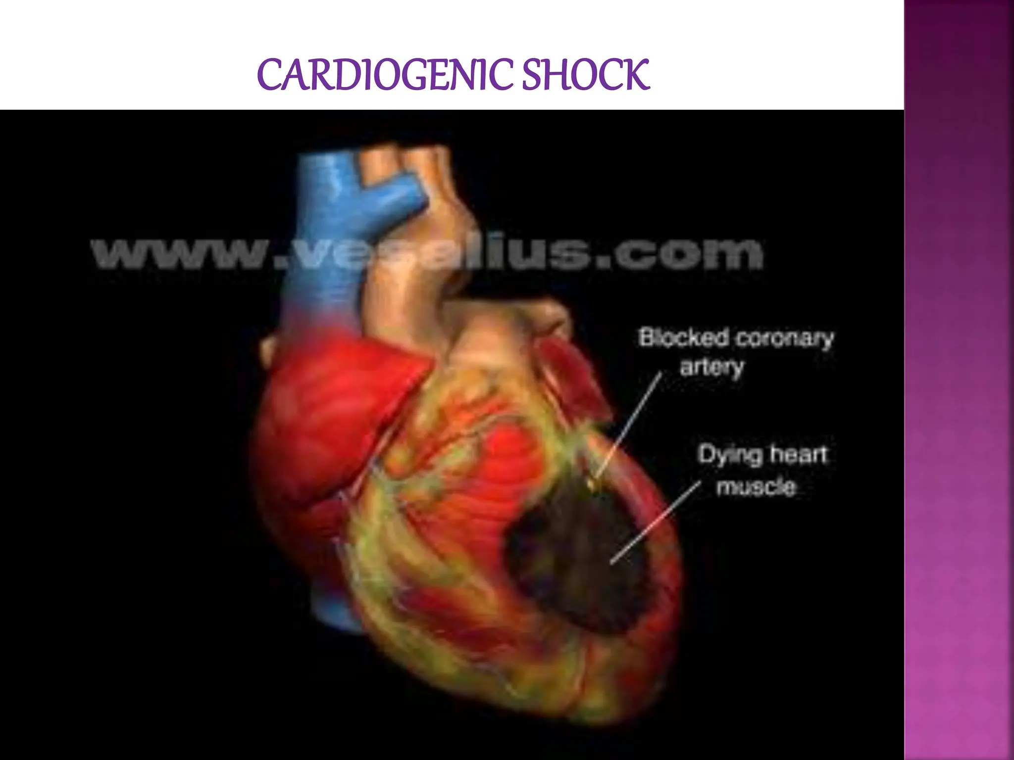 SHOCK.pptx bbbbbbbbbbbbbbbbbbbbbbbbbbbbbbbbbbbbbbbbbbbb | PPTX